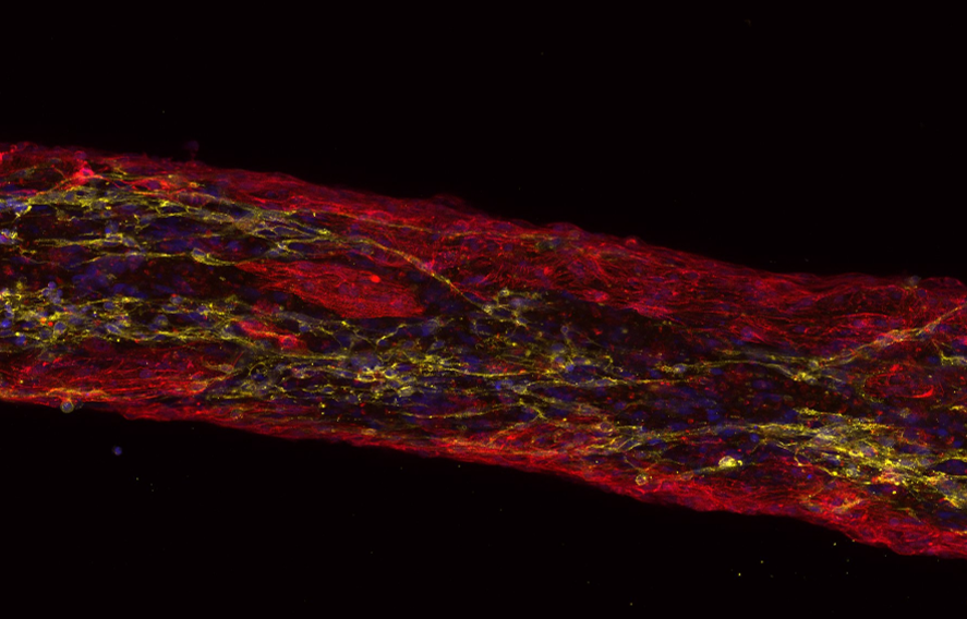 Heart-on-chip | Applied Stem Cell Technologies